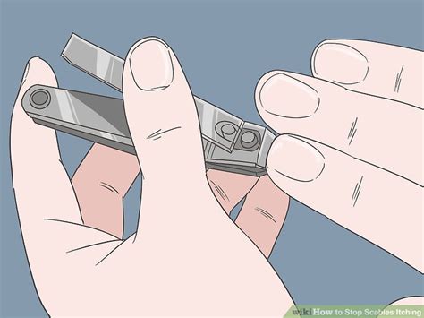 How To Stop Scabies Itching Steps With Pictures WikiHow Health