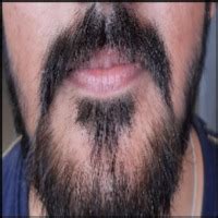 Oral Detection Object Detection Dataset And Pre Trained Model By Vijay