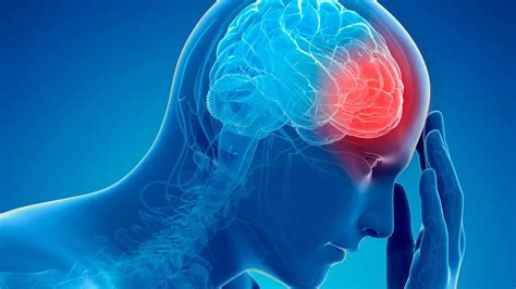 Can Adhd Cause Headaches