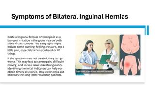 Bilateral Inguinal Hernia Repair What You Need To Knowpdf