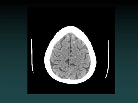 Introductory Neuroimaging What You Need To Know At 3 Am And Some Cool Stuff презентация онлайн