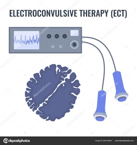 Electroconvulsive Therapy Severe Depression Schizophrenia Treatment Ect Electrodes Placement