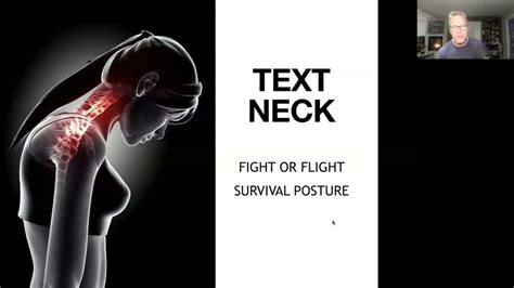 Text Neck Platysma Muscle Exercise Youtube