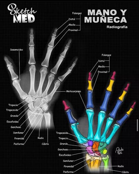 Anatomia Cabeza Y Cuello Anatomia Del Hueso Anatomia Humana Huesos