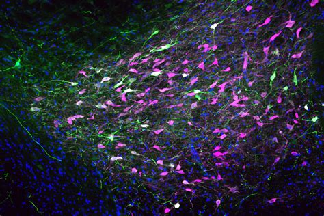 Female Sex Hormone Protects Against Opioid Misuse Rat Study Finds