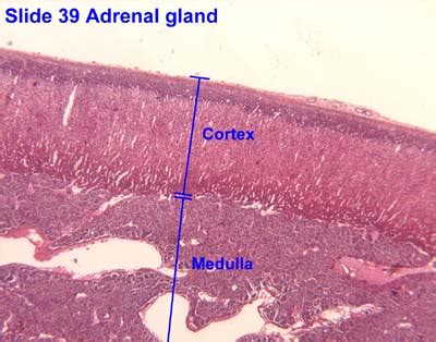 Adrenal Gland Slide Adrenal Carcinoma Diagnosis And Disease