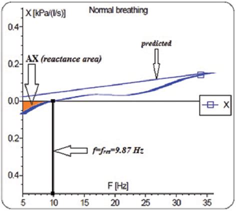 Impulse Oscillometry Ios Depiction Of The Reactance Xrs Frequency Download Scientific
