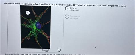 Solved Within The Microscope Image Below Identify The Type Chegg Com