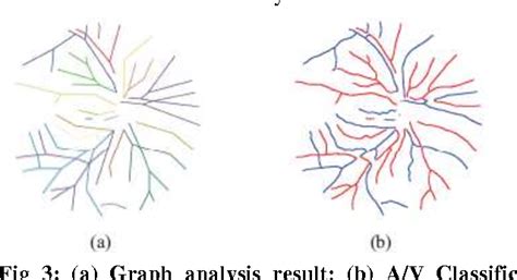 Figure 3 From Retinal Images Classification Using Graph Based Approach For Disease