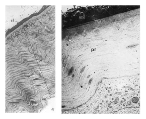 The Larval Integument And Its Structures The Integumentary System Of