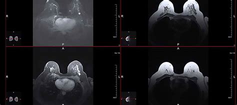 Mri Tech Classes In Austin Tx December 2025 Update Pulse Radiology