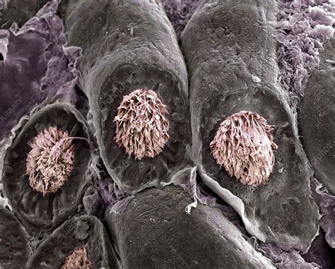 Epididymis Sem Stock Image P608 0112 Science Photo Library