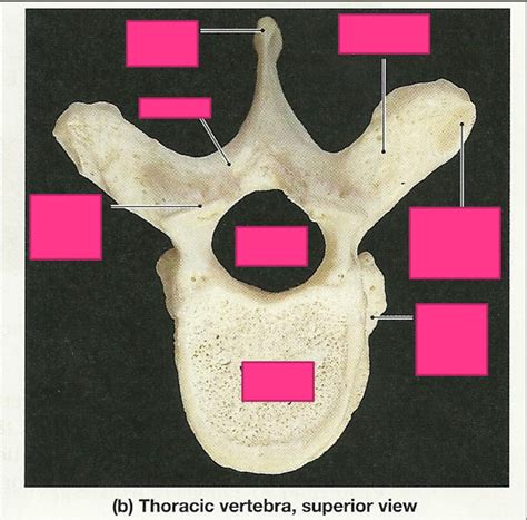 Thoracic Vertebrae Superior View Diagram Quizlet