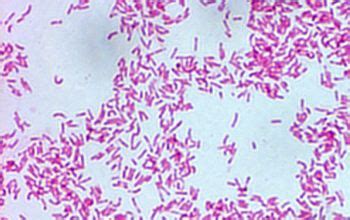 Campylobacter Ureolyticus