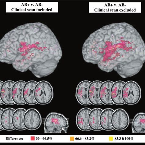 Within Groups Comparison Of Action Recognition Data Ideomotor Apraxia