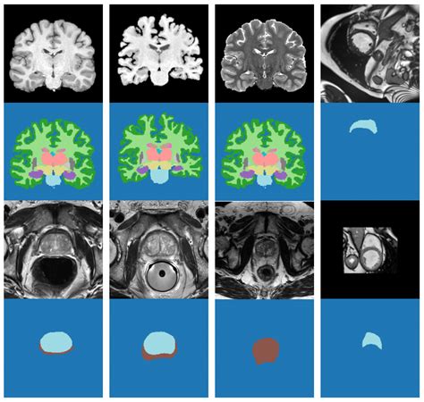 figure shows examples of images from the datasets used in our