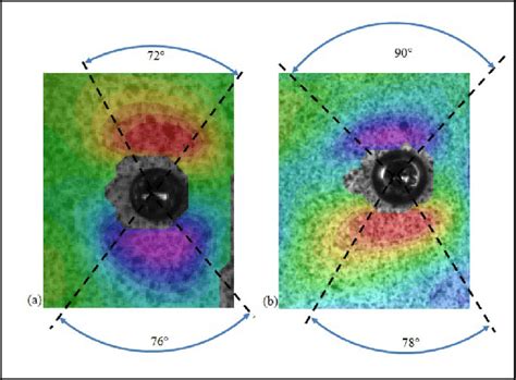 Qualitative Strain E Yy Field For The Dtn A And Etn B Screws