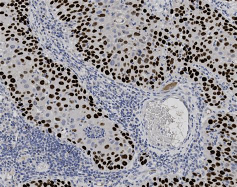 Tissue Tek Genie Rapid True Random Access Ihc Staining
