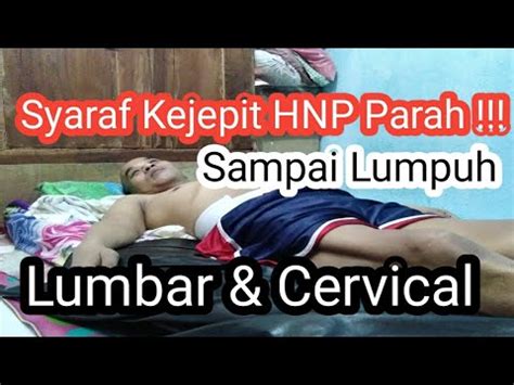 Terapi pijat urut syaraf kejepit HNP lumbar cervical | Pasien lumpuh | Terapi ke-6 - YouTube