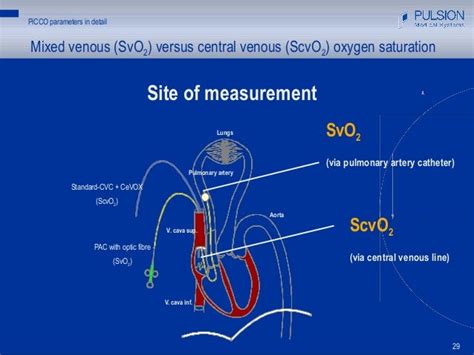 Physiology Of Hemodynamics And Picco Parameters In Detail