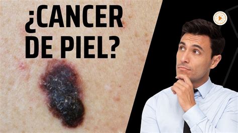3 Tipos De Células Cancerosas De La Piel