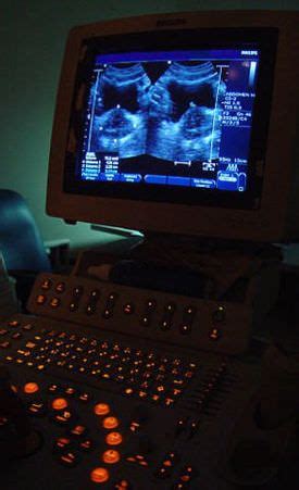 Sonogram Vs Ultrasound Difference And Comparison Diffen