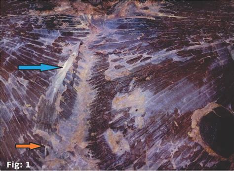 National Journal Of Clinical Anatomy