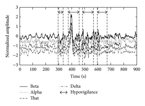Example Of EEG Signal For An Operator Where Sequences Enclosed By Download Scientific Diagram