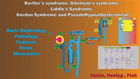 Bartter Syndrome Gitelman Syndrome Liddles Syndrome Gordon Syndrome And