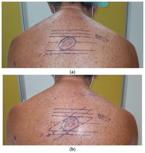 Parallelogram Excision An Algorithmic Approach For Excision Designs In