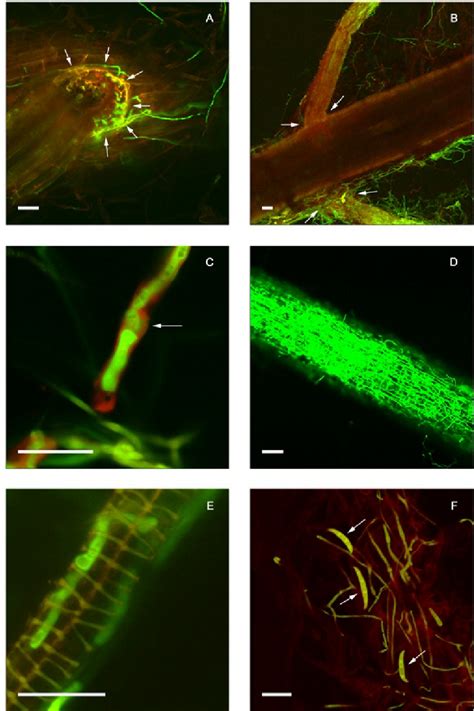 Late Stages Of Tomato Root Colonization And Infection By Fusarium Download Scientific Diagram