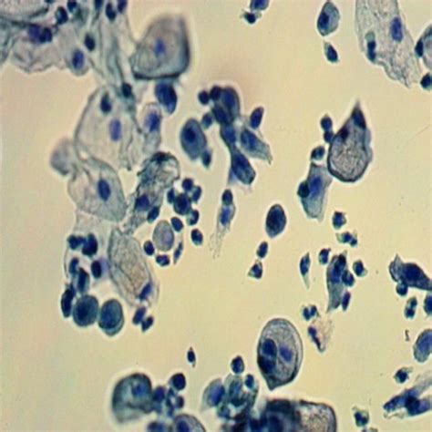 Cell Detection Object Detection Dataset By Learning Ai