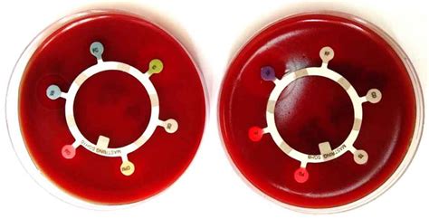 The Combination Disk Diffusion Test Of Enterococcus Strain With Some Download Scientific
