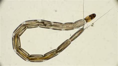 130 Midge Larvae Stock Videos And Royalty Free Footage Istock