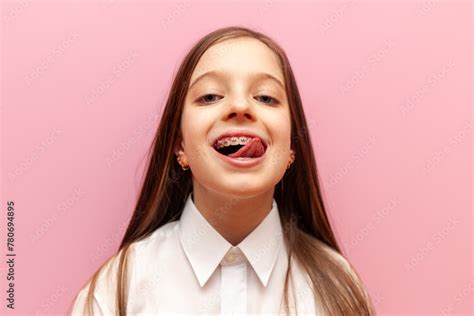 Little Teenage Girl With Braces Licks Her Lips And Shows Tongue On Pink