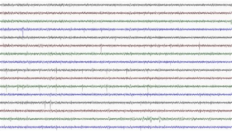 Spike Sorting Becomes Fully Automated