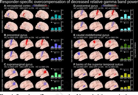 Figure 1 From Journal Pre Proof Oscillatory Network Markers Of