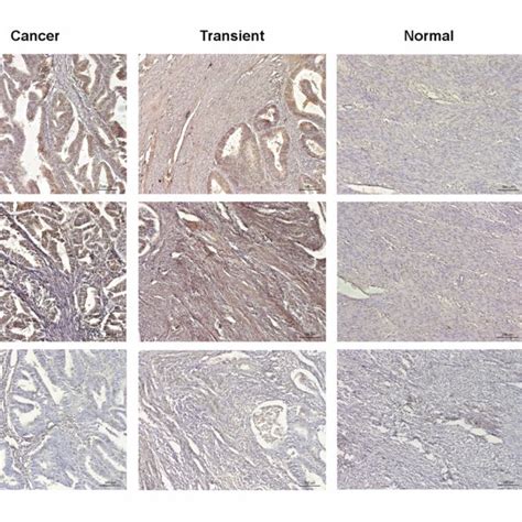 Representative Photographs Of Ihc Staining For Mmp2 A Mmp16 B And