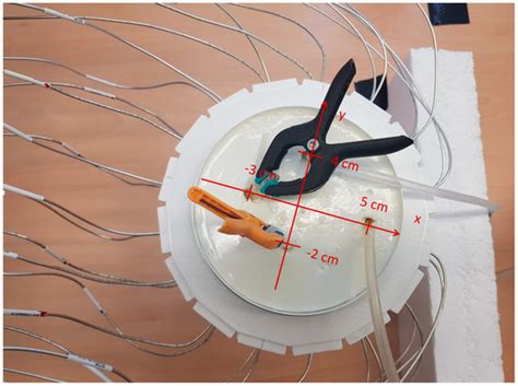 Diagnostics Special Issue Advances In Biomedical Microwave Imaging And Sensing