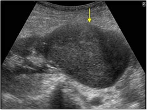 Urinary Tract And Male Reproductive System 2 1 Kidney And Ureter