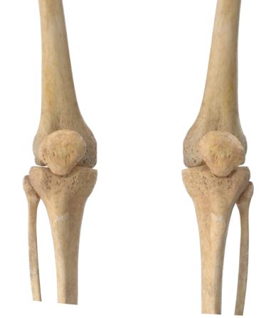 Tibia Fracture Dr Anastasios Lampropoulos