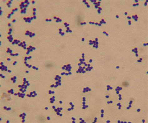 Table 1 1 From Of Chromosomal And Plasmid Dna Profiles Of Lactococcus Lactis Ssp Lactis