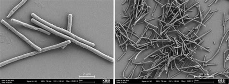 A Field Emission Scanning Electron Microscope Fe Sem Image Of