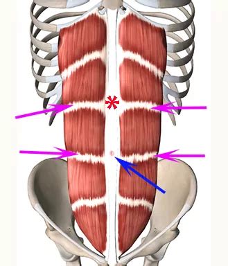 Lesson Rectus Sheath Usabcd