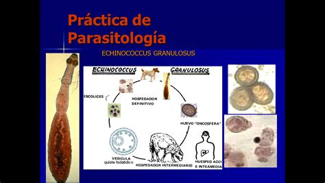 Practicas De Parasitologia Echinococcus Granulosus