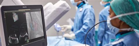 Left Atrial Appendage Occlusion Philips