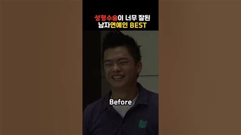 성형수술이 너무 잘 된 남자연예인 Best 12 Youtube