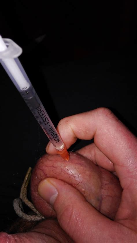 Inyeccion Alcohol Porn Pictures XXX Photos Sex Images PICTOA