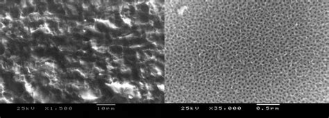 Sem Micrographs Of Tio 2 Nanostructured Nanoporous Layer Developed On