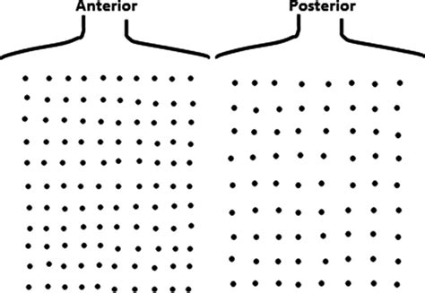 Electrode Arrays In The Case Of 182 Electrodes Download Scientific Diagram